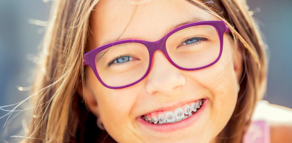 What Braces Color Should I Get Quiz Proprofs Quiz
